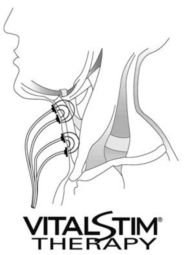 VitalStim therapy for swallowing - Hospital Rehabilitación San Vicente